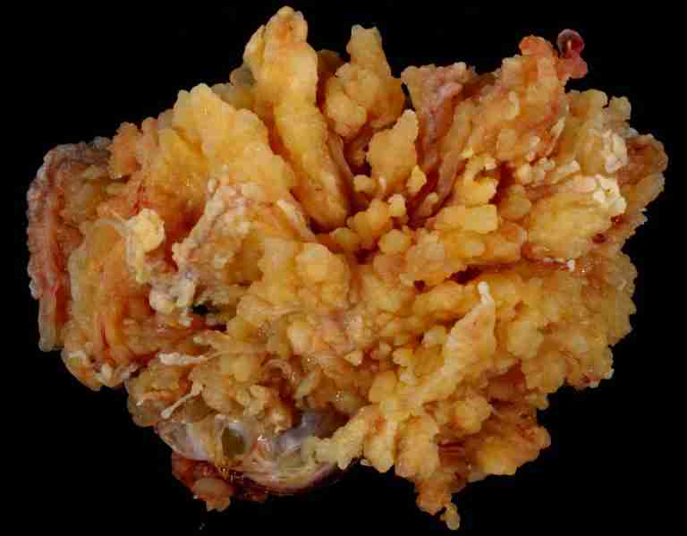 70 Creepy Facts That Will Keep You Up at Night - Amazing Facts Home